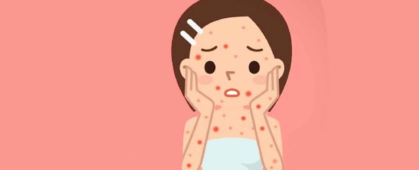 Tudo que você precisa saber sobre o sarampo - Ponto Biologia